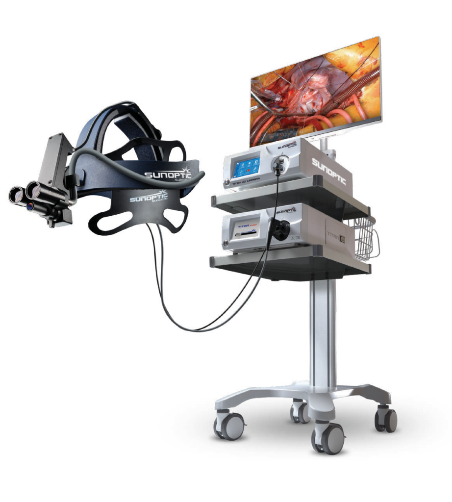 HDC300 Surgical Headlight Camera | Surgical Camera System